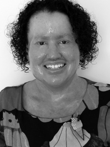 » Read a Q&A with Carly Findlay on Growing Up Disabled in Australia!The ...